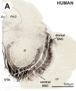 VTA – The Science of Parkinson's