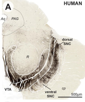 VTA – The Science of Parkinson's