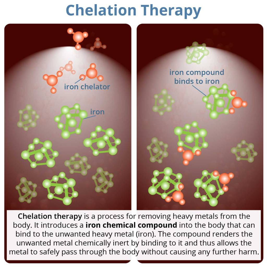 Iron, life force, and Parkinson’s disease – The Science of Parkinson's