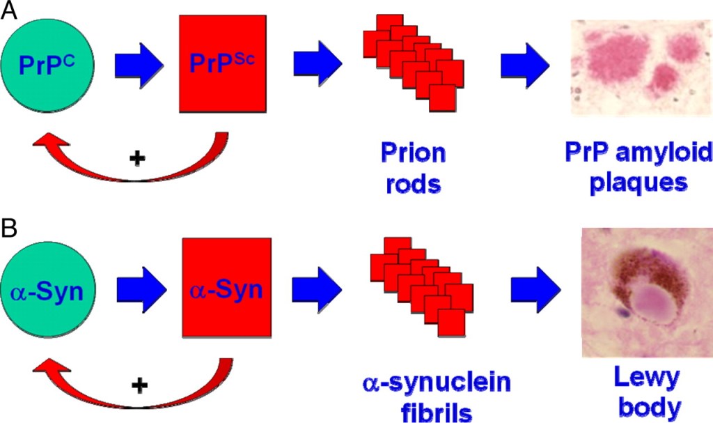 Differentiating PD from MSA – The Science of Parkinson's