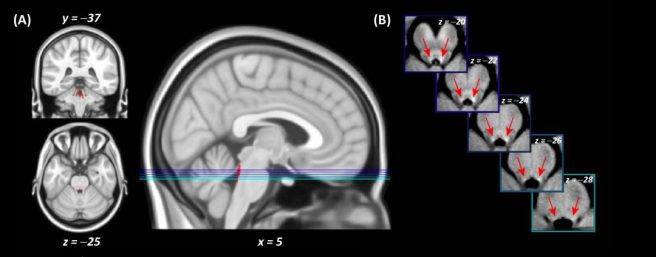 Curasen: Shifting the focus from just dopamine – The Science of Parkinson's